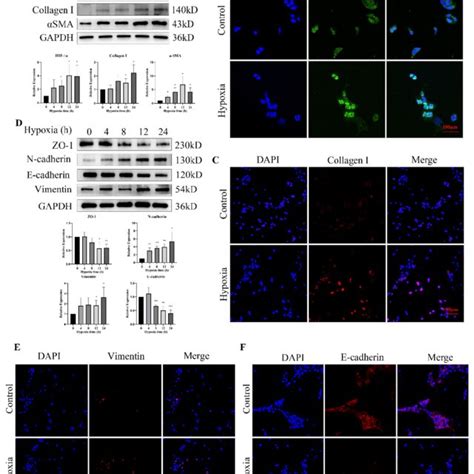 Hypoxic Exposure Induced The Nuclear Translocation Of Hif 1α In Download Scientific Diagram