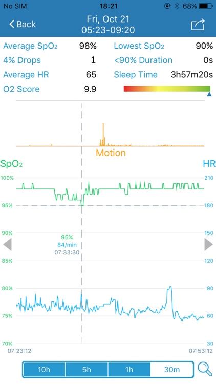 Check O2 By Shenzhen Viatom Technology Co Ltd