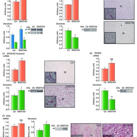 Aortic Tissue Histology A Orcein Staining Of Media From A