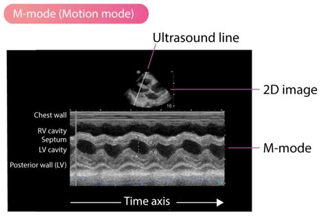 M Mode Motion Mode Echocardiography The Cardiovascular