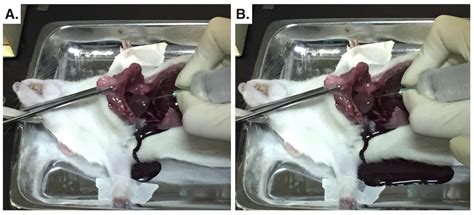 Perfusion Just Beginning A And Near The End Of The Process B
