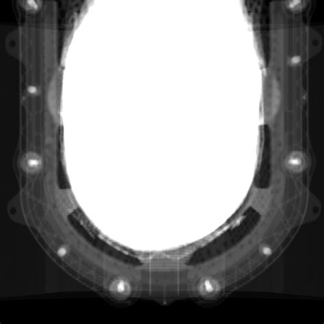there are deviations between generated drr image and corresponding epid