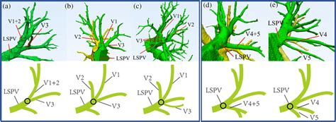 Vein Branching Pattern Of Lul Upper Stem A Two‐branch B Download Scientific Diagram