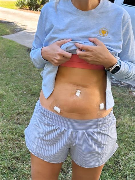 My Brca Surgeries Part Two Sweet Southern Prep