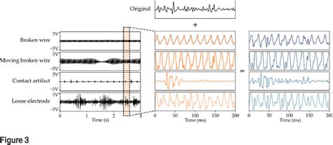 Figure 3 From Data Augmentation And Deep Learning Techniques To Improve