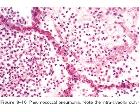 Figure 8 10 From General Principles Of Microbial Pathogenesis 309