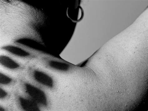 Soft Tissue Sarcoma In The Shoulder What To Know