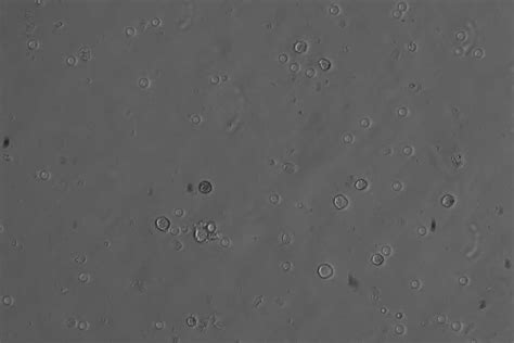 Artificial Tail Less Sperm Is The Best Test Tube Sex Cell Yet New Scientist