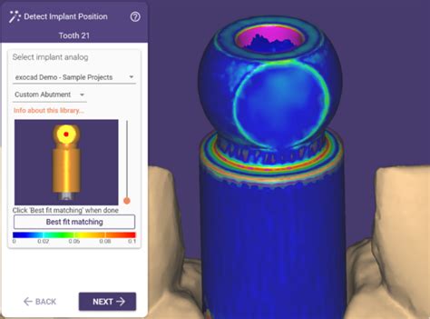 Matching The Scan Abutments Exocad
