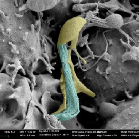Array Tomography For Sem 3d Reconstruction Microscopy Focus