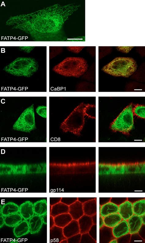 Intracellular Localization Of Fatp4 Gfp A Intracellular Reticular