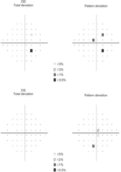 Total Deviation And Pattern Deviation Maps For Sap Humphrey Perimetry Download Scientific