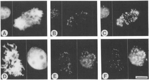 Tagged Full Length And Carboxyl Terminal Deletion Proteins Localize To