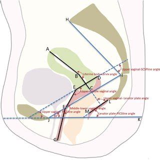 PDF Comparison Of The Axes And Positions Of The Uterus And Vagina Between Women With And