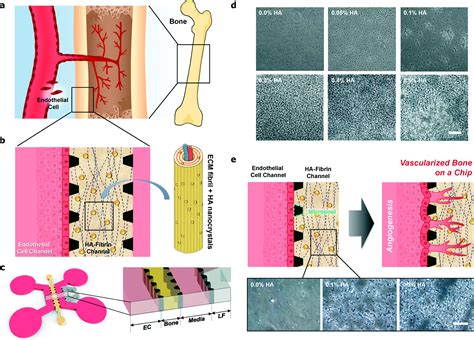Extracellular Matrix Bone