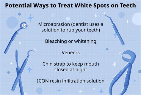 White Spots On Teeth Causes Treatment And Prevention