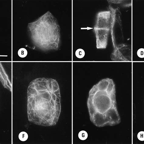 A Almost All Afs In This Plasmolysed Cell Are Located Within The Download Scientific Diagram