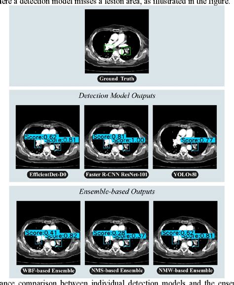 Figure 1 From Deep Learning In Computed Tomography Pulmonary
