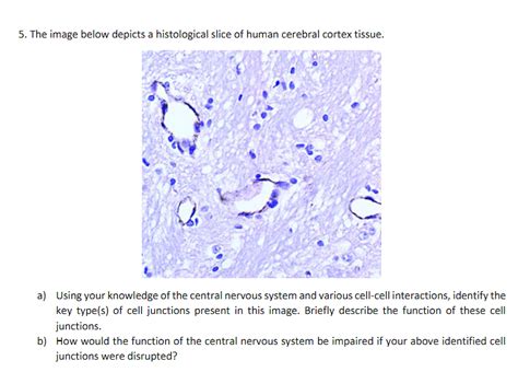 Solved 5 The Image Below Depicts A Histological Slice Of