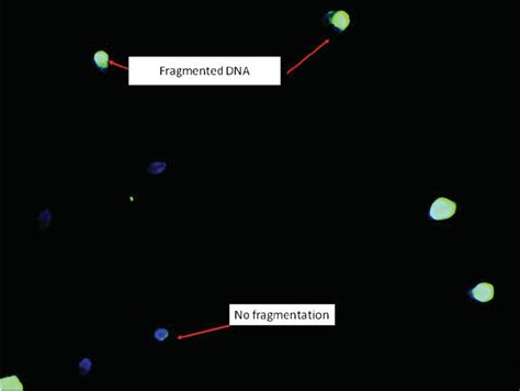 In Situ Determination Of Sperm Dna Fragmentation With Tunel Pale