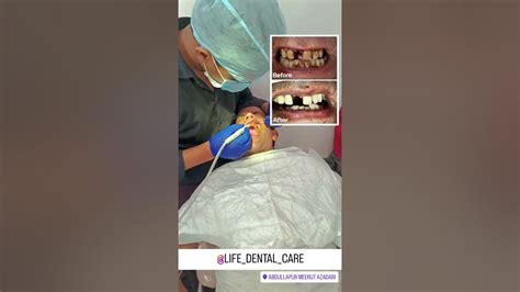 15 August 2024 Youtube