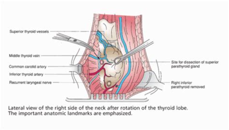 Parathyroidectomy Anatomy