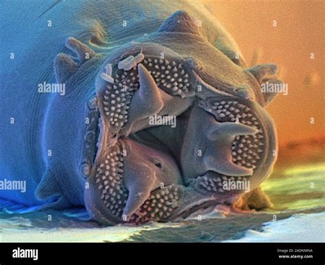 Nematode Worm Coloured Scanning Electron Micrograph Sem Showing The