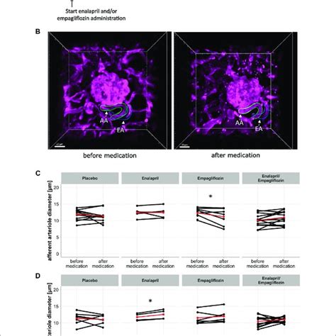 single nephron glomerular filtration rate in stz diabetic mice a