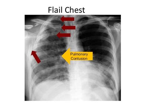 Pin On Radiology