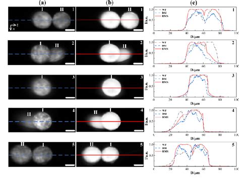 Figure 1 From Dynamic Speckle Illumination Wide Field Fluorescence Microscopy With Actively
