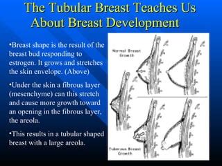 Vip Room Breast Shape Talk Ppt