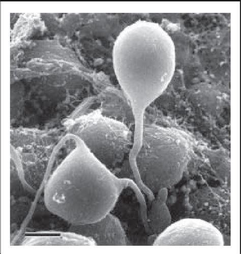 Unipolar Neuron Under Microscope