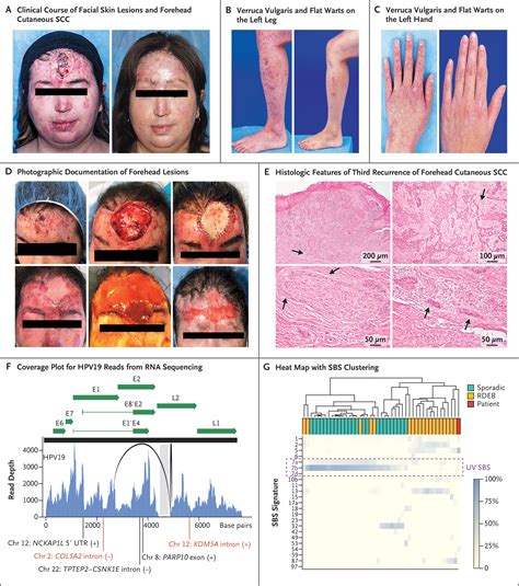 Skin Cancer Is Hpv Also A Potential Cause