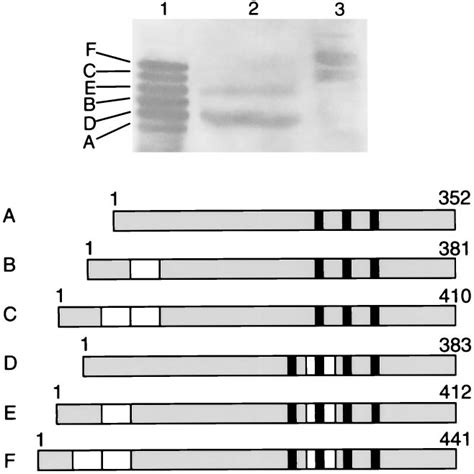 Immunoblots Of Sarkosyl Insoluble Tau From Familial Mstd Brain Before Download Scientific