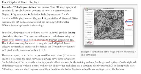 trainable weka segmentation how to start image analysis image sc