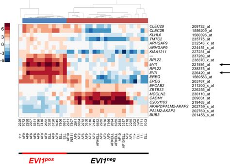 Supervised Gene Expression Profiling Of Mll Rearranged Amls Uncovers 2