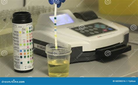 Urine Analysis Test Strips On The Study Analyzer Stock Footage Video
