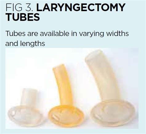 Laryngectomy Stoma Tube