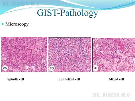 Gist Pptx Digestive Disorders Diseases And Conditions