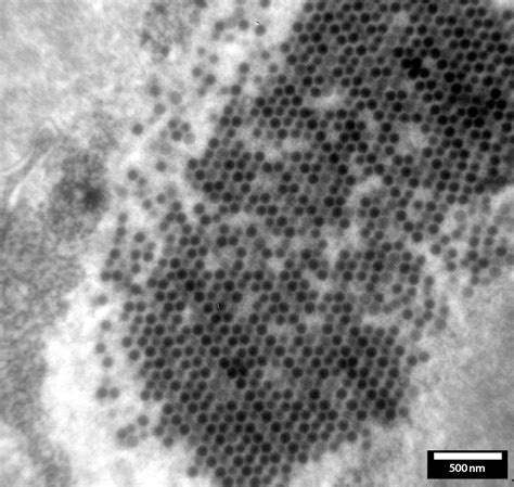 Exploring Cell Biology With Transmission Electron Microscopy Tem