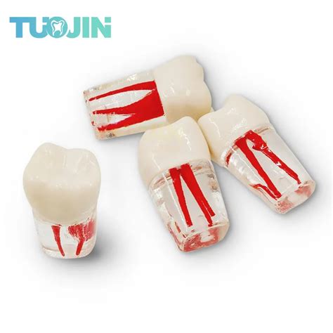 2pcs 치과 훈련 제품 학생을위한 치과 근관 치아 연습 모델 연구 교육 치과 기술자 실험실치과 교육 모델 Aliexpress