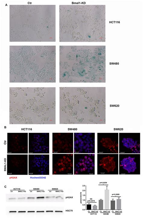 Bmal1 Knockdown Triggers Different Colon Carcinoma Cell Fates By Altering The Delicate