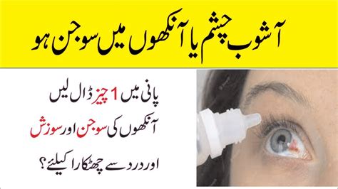 Ashob E Chasham Ankho Ki Bemari Ka Ilaj Amazing Deep Quotes Youtube