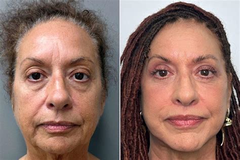 Woman 70 Says She Was Always Confident Then She Spent 8 Hours