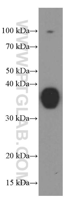 Synaptophysin Antibody 60191 1 Ig Proteintech Synaptophysin Antibody 60191 1 Ig Proteintech