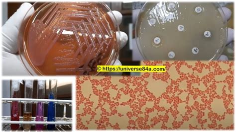 Acinetobacter Introduction Morphology Pathogenicity Laboratory