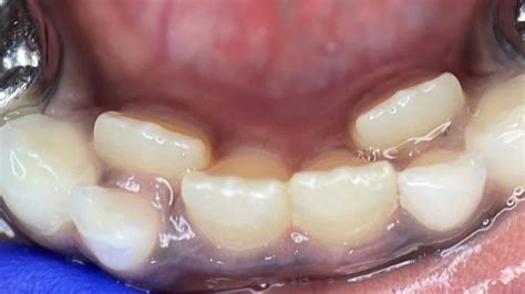 Two Rows Of Teeth Nephilim