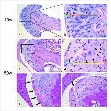 Frontal Sections Of The Mandibular Condyle Stained With Hematoxylin And Download Scientific