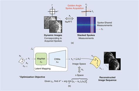 Ieee Signal Processing January 2023generative Models For Inverse Imaging Problems