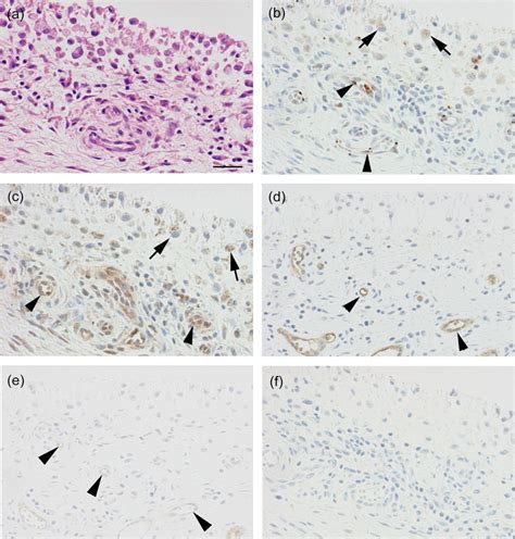 Immunolocalization Of Adam15 Vegfr 2 Vwf And Cd31 In Rheumatoid Download Scientific Diagram
